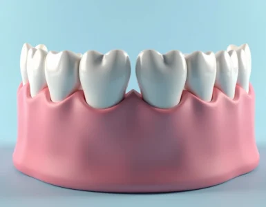 Infecção na boca: conheça as 7 principais e como tratar